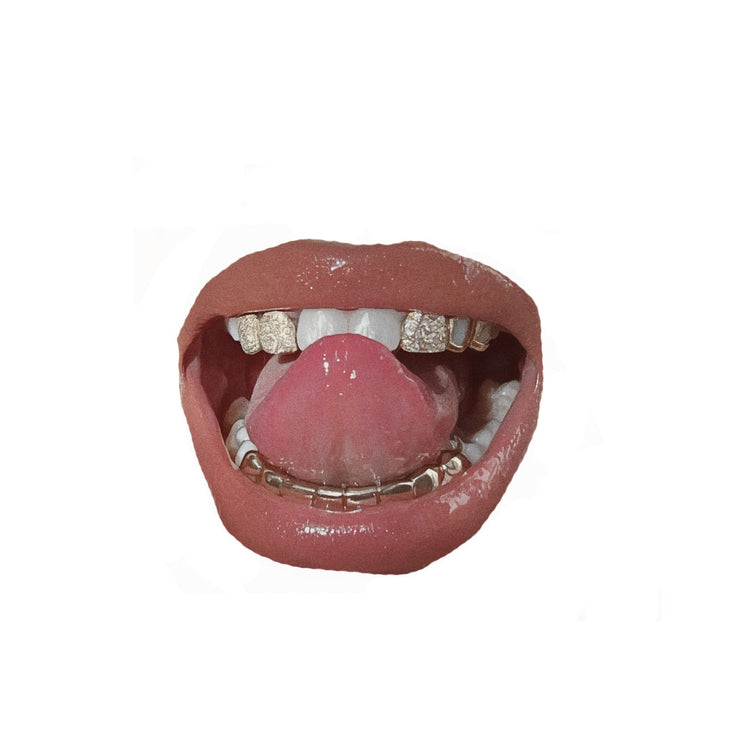 EASE – Home of the Protective Mouth Grill | Custom Grills & Protective
